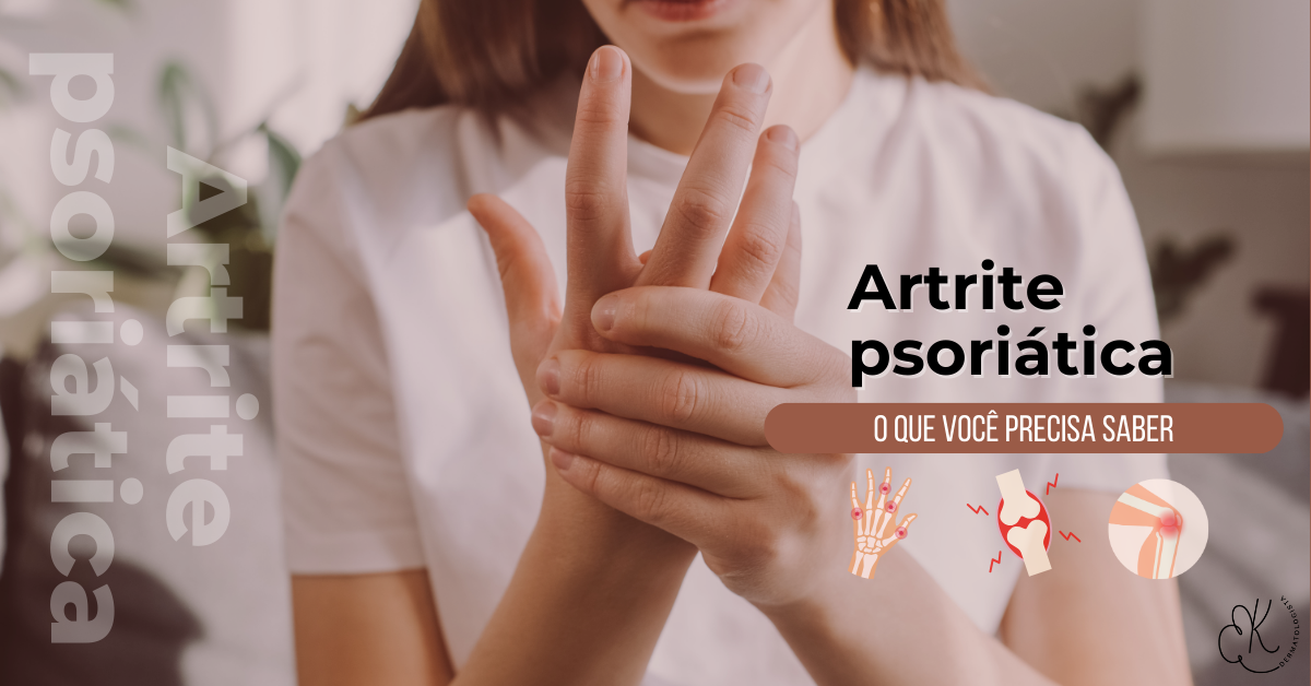 Artrite Psoriática: o que você precisa saber