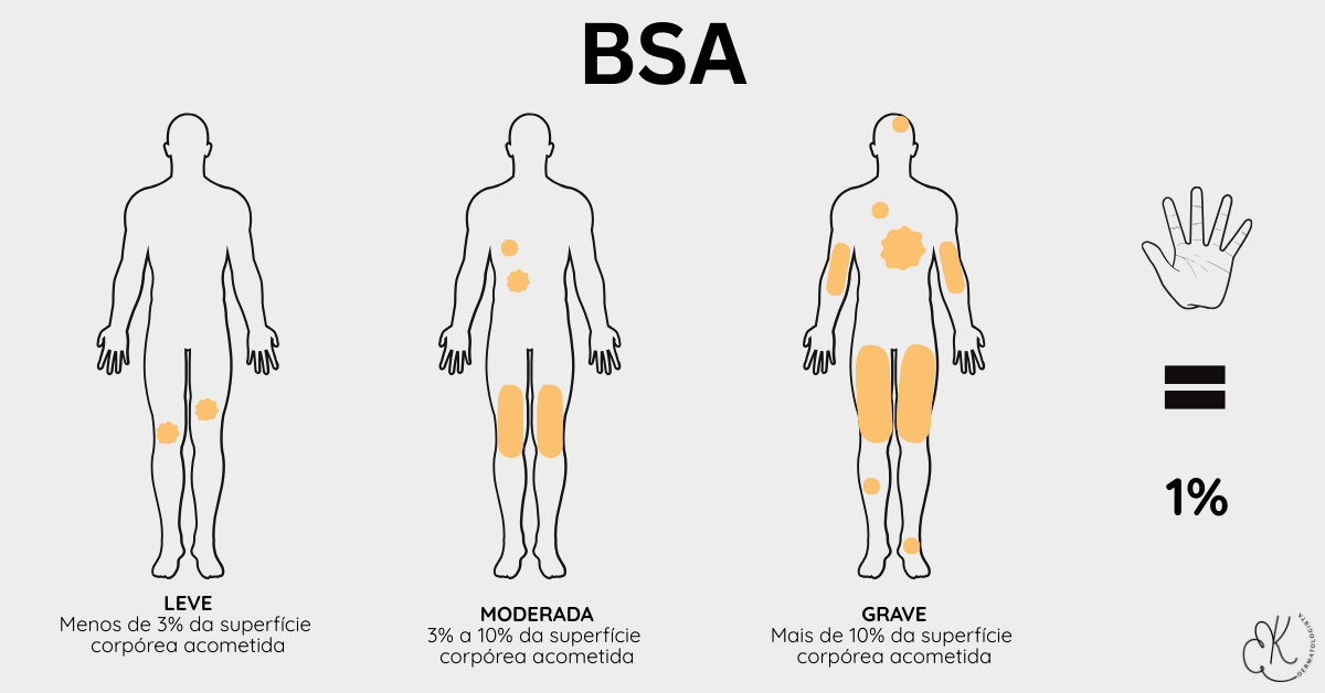 Como avaliar a gravidade da psoríase: BSA, PASI e DLQI