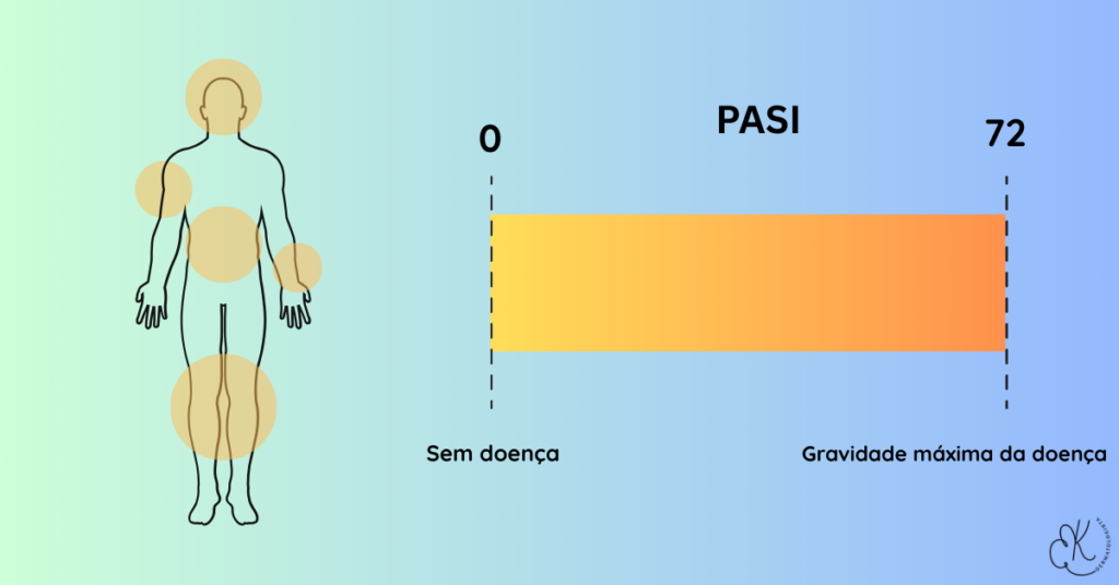 Como avaliar a gravidade da psoríase: BSA, PASI e DLQI